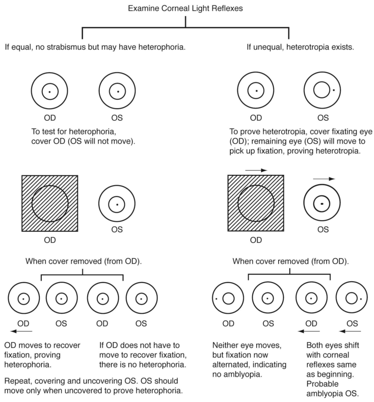Testing Accommodative and Convergence Disorders in children - An Eye ...